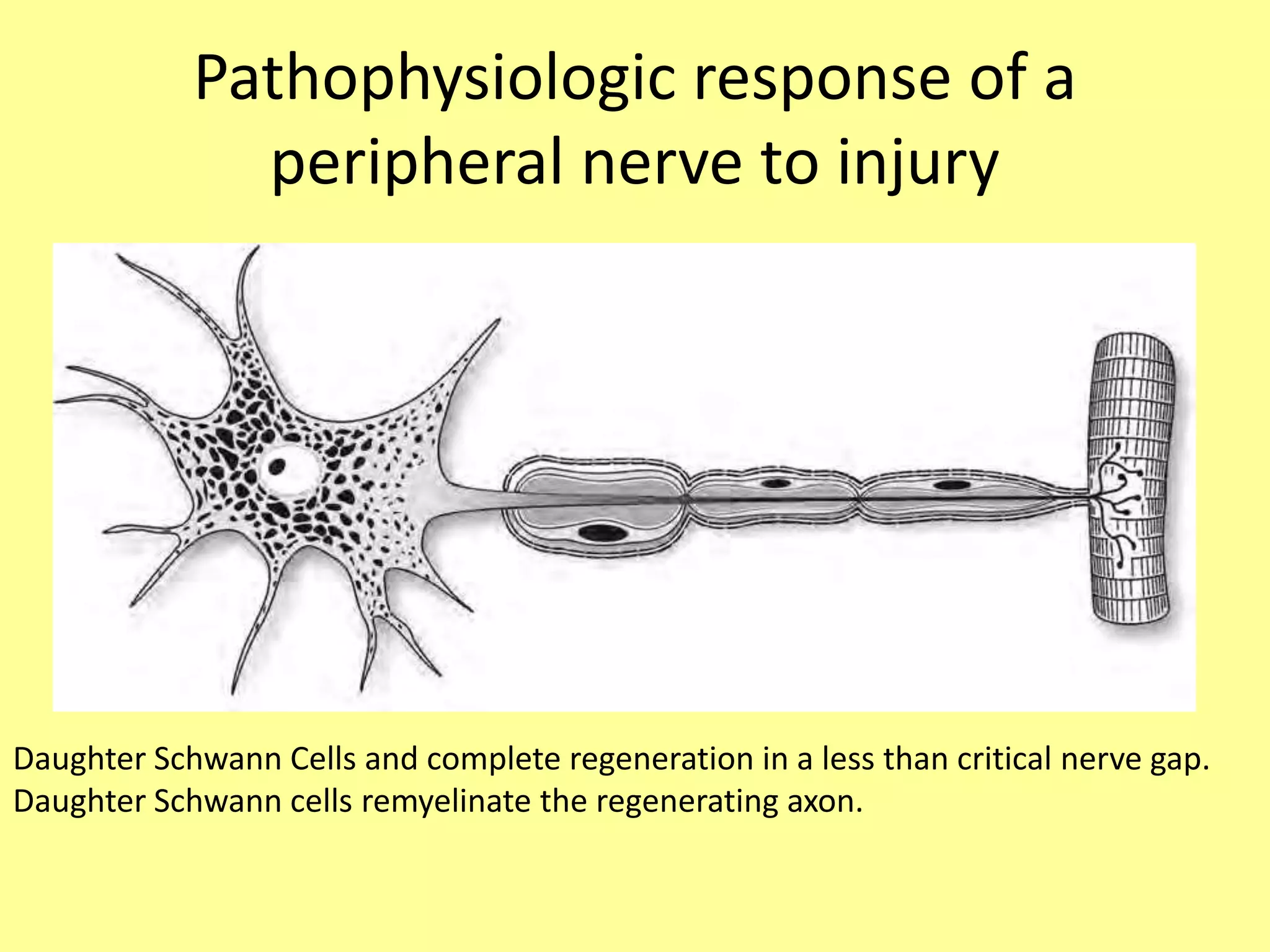 Nerve injuries during impaction surgeries | PPTX