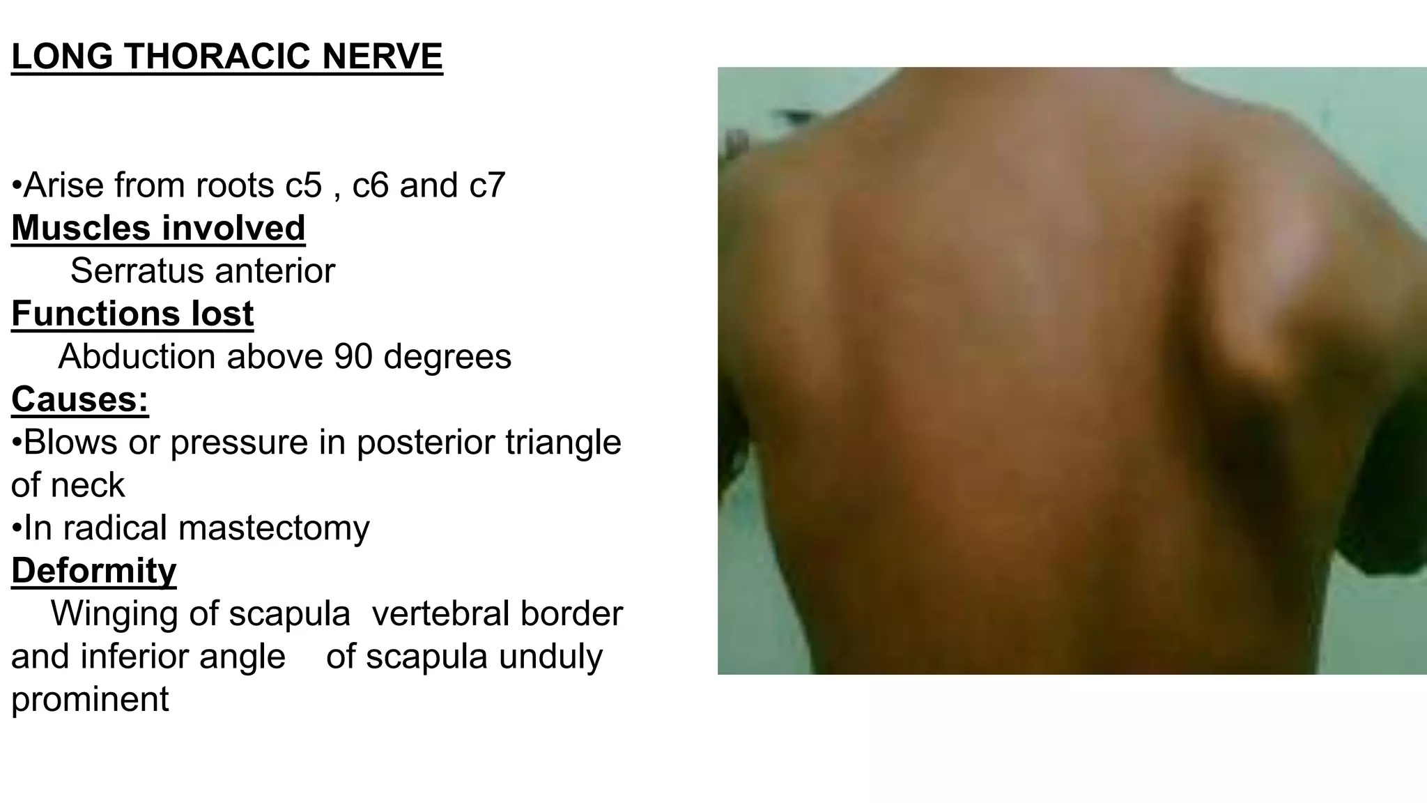 Nerve injuries of Upper Limb | PPTX