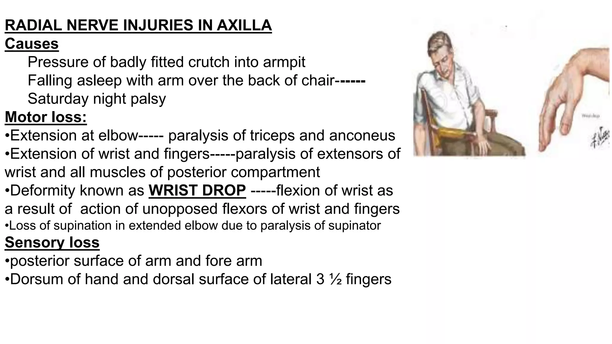 Nerve injuries of Upper Limb | PPTX
