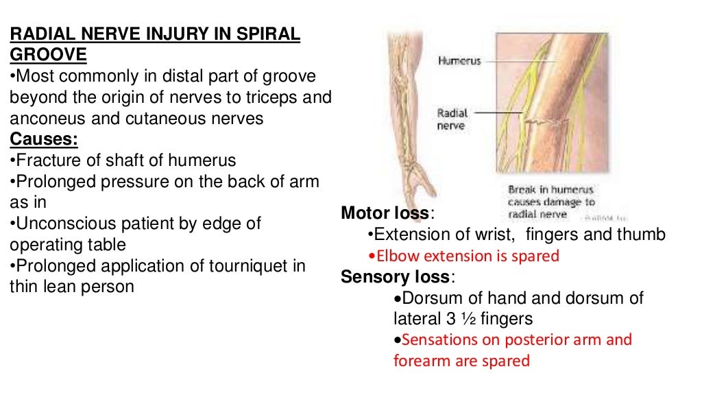 Nerve injuries of Upper Limb