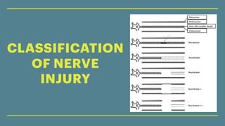 Nerve injuries | PPT