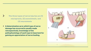 Nerve injuries | PPT