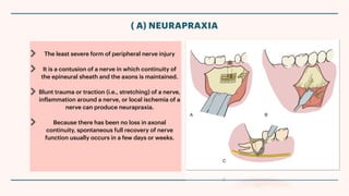 Nerve injuries | PPT