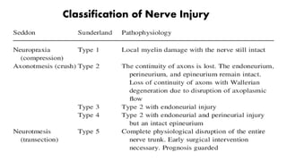 Nerve injuries | PPT