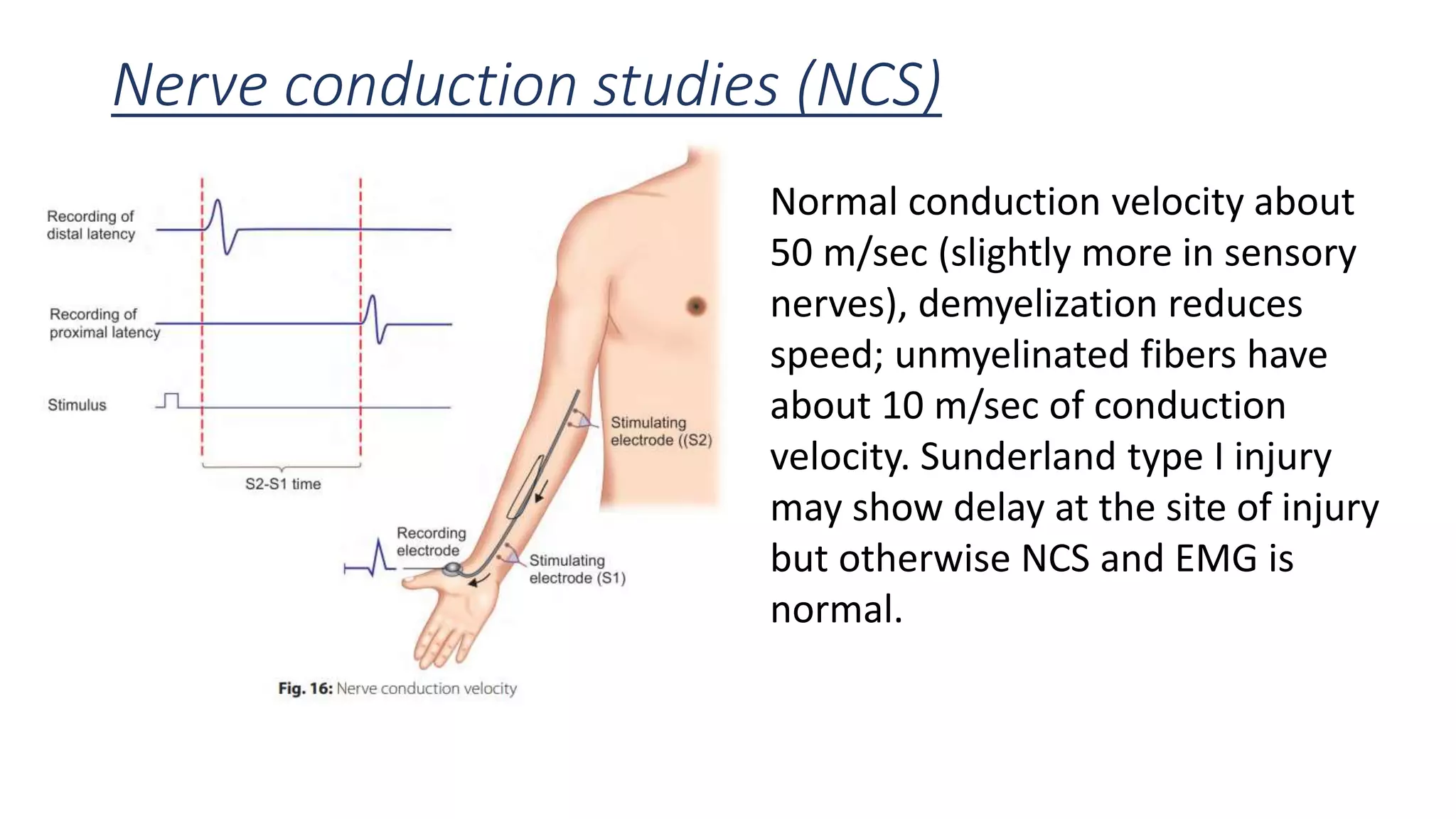 Nerve injuries | PPTX