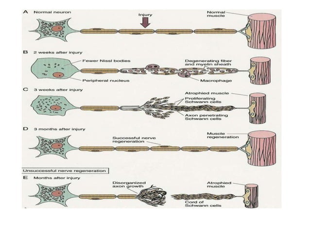 Nerve Injuries and its management techniues.pptx