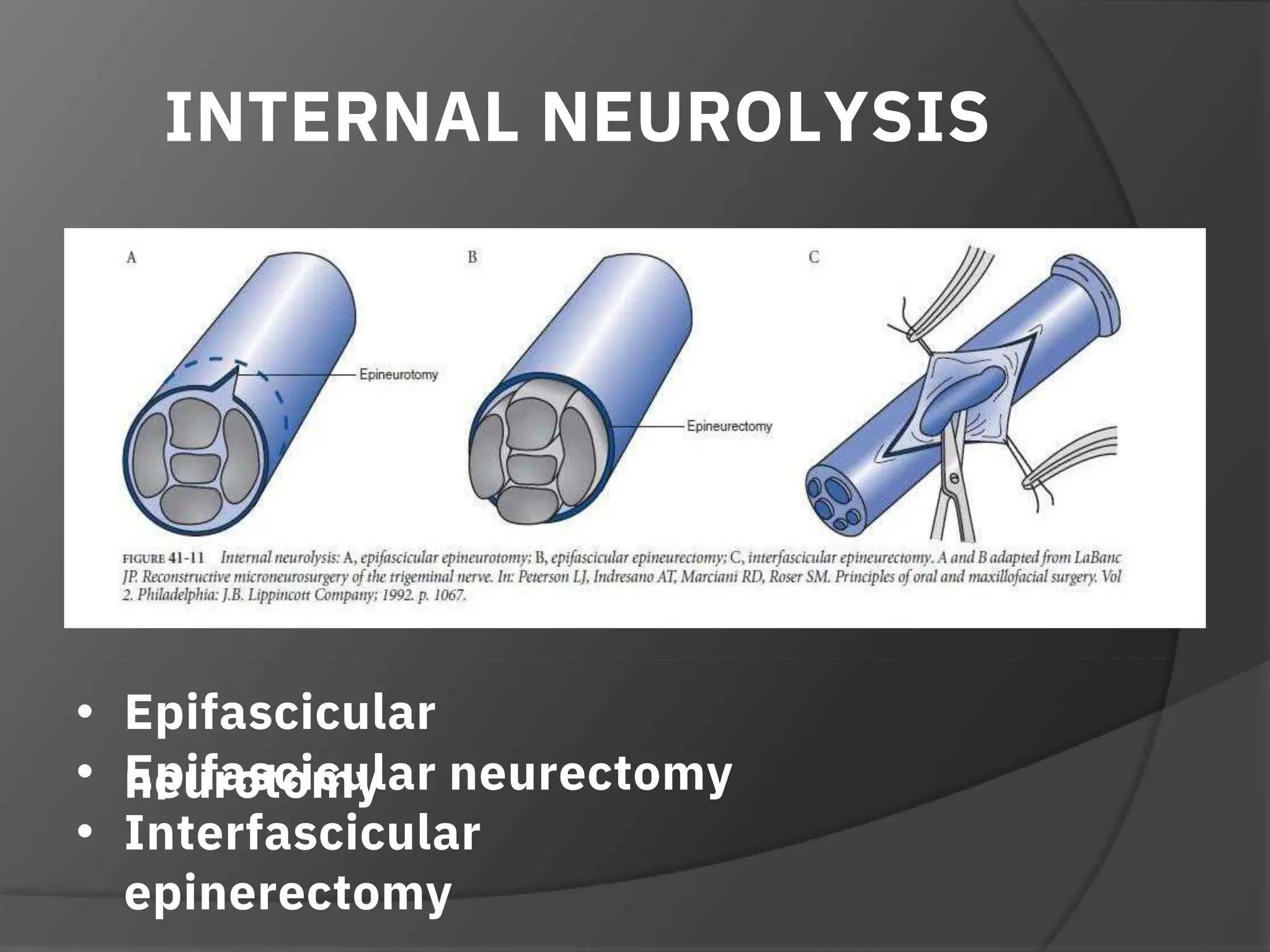Nerve injuries seen in oral and maxillofacial surgery | PPTX