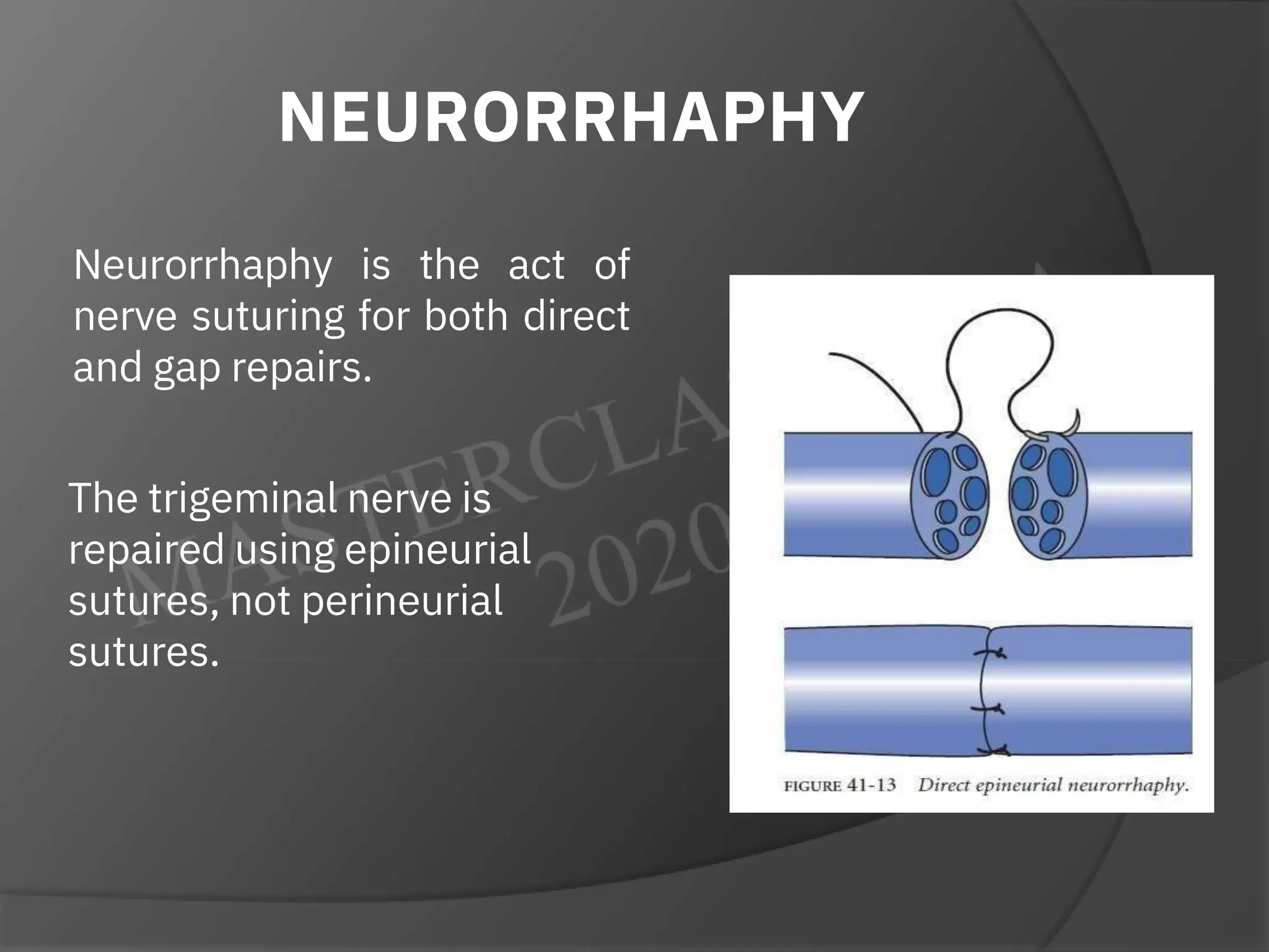 Nerve injuries seen in oral and maxillofacial surgery | PPTX
