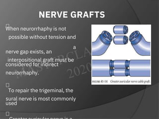 Nerve injuries seen in oral and maxillofacial surgery | PPTX