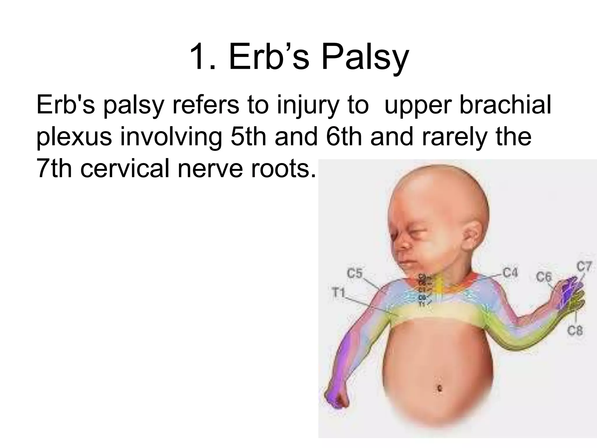 Nerve injuries ,fracture bone and dislocations in newborn part II | PPTX