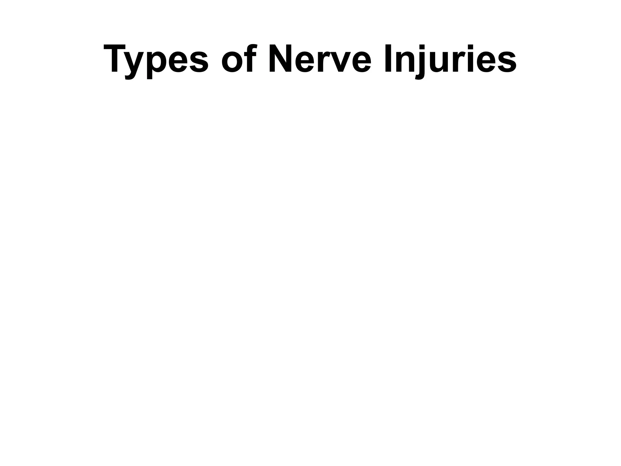 Nerve injuries ,fracture bone and dislocations in newborn part II | PPTX