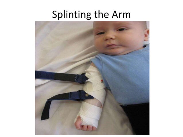 Nerve injuries ,fracture bone and dislocations in newborn part II | PPTX