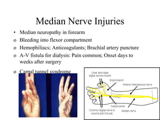 Nerve injuries prof g s patnaik | PPT