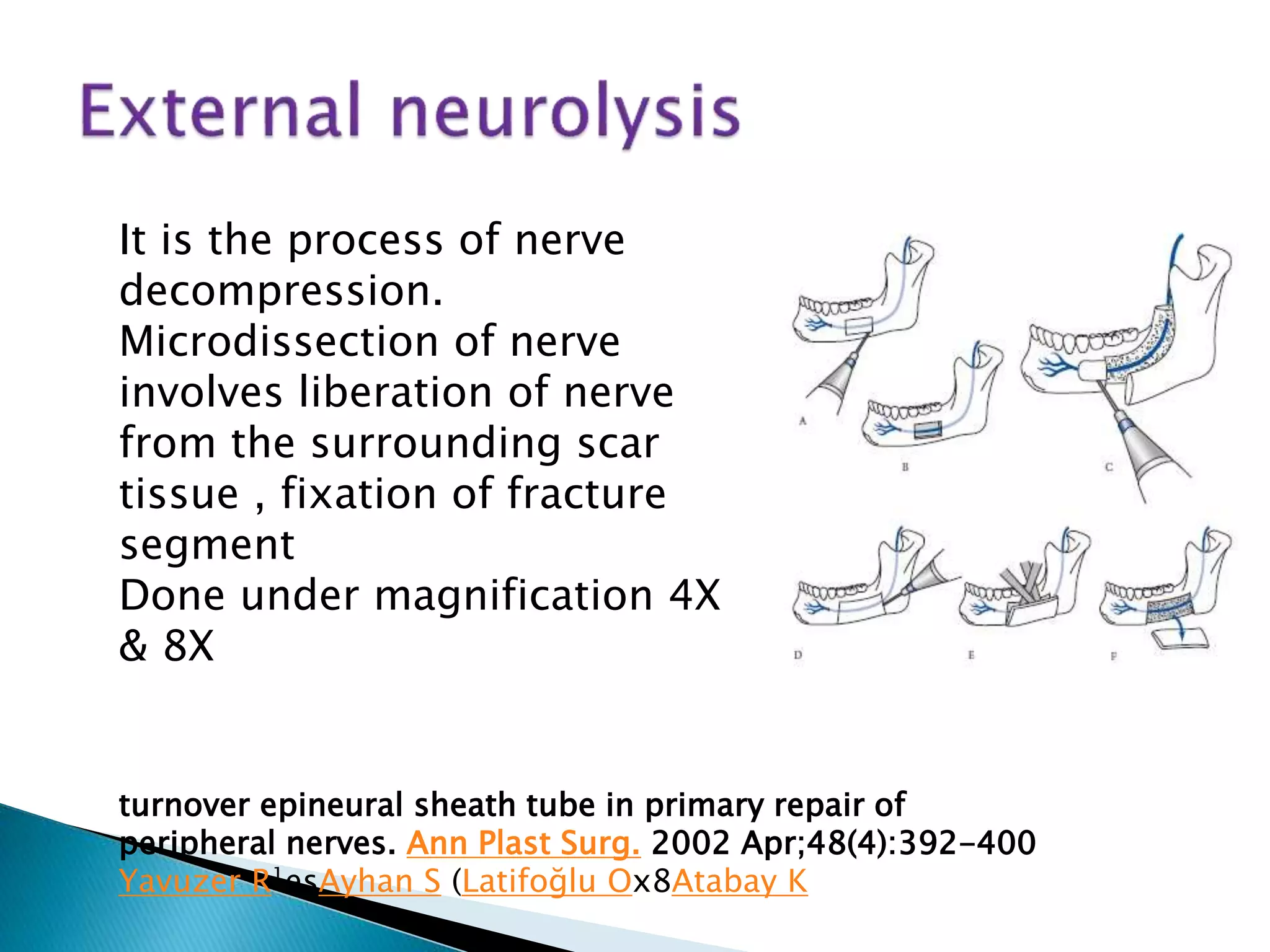 Nerve injury | PPTX