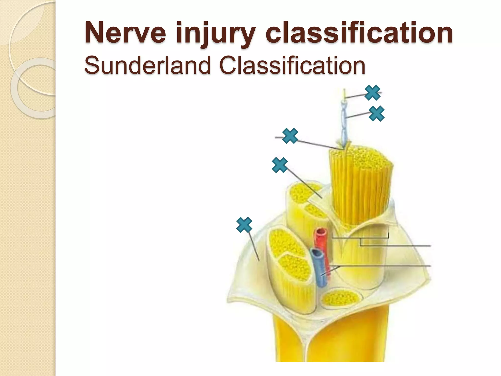 Nerve injury | PPTX
