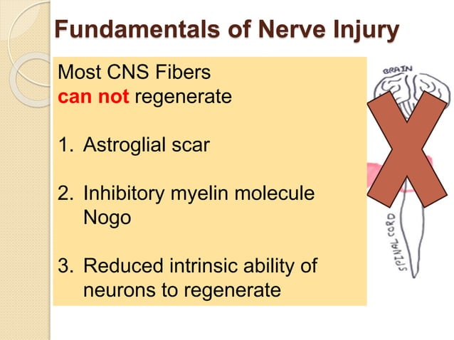 Nerve injury | PPT