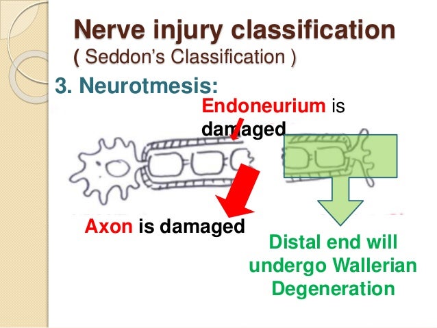 Nerve injury