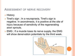 nerve injury kjNOCNIUABCIUBIWEUBIUBUKWBIUBIW | PPT
