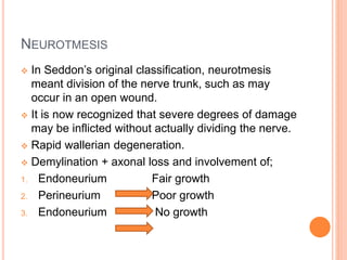nerve injury kjNOCNIUABCIUBIWEUBIUBUKWBIUBIW | PPT
