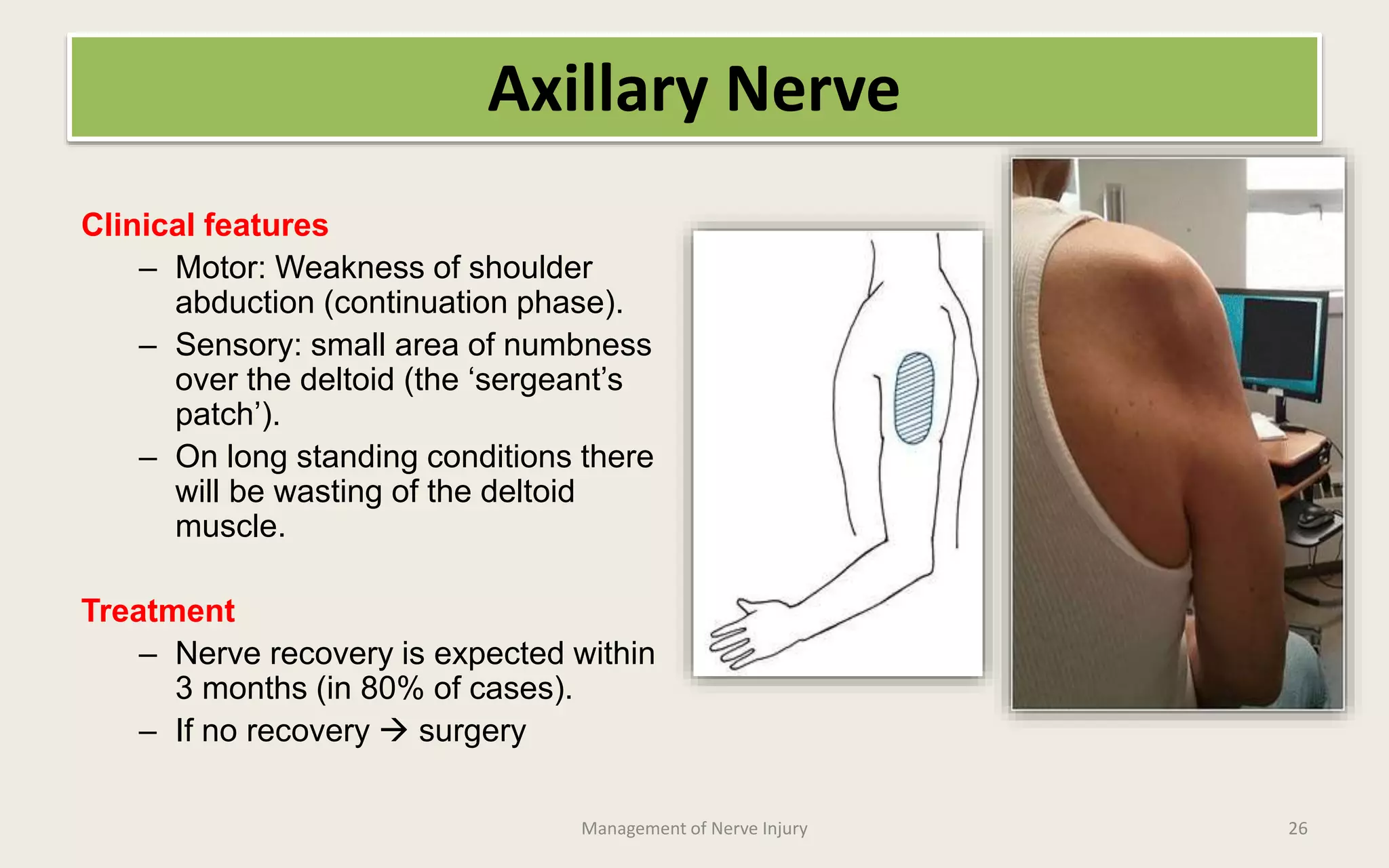 Management of Nerve Injury | PPTX