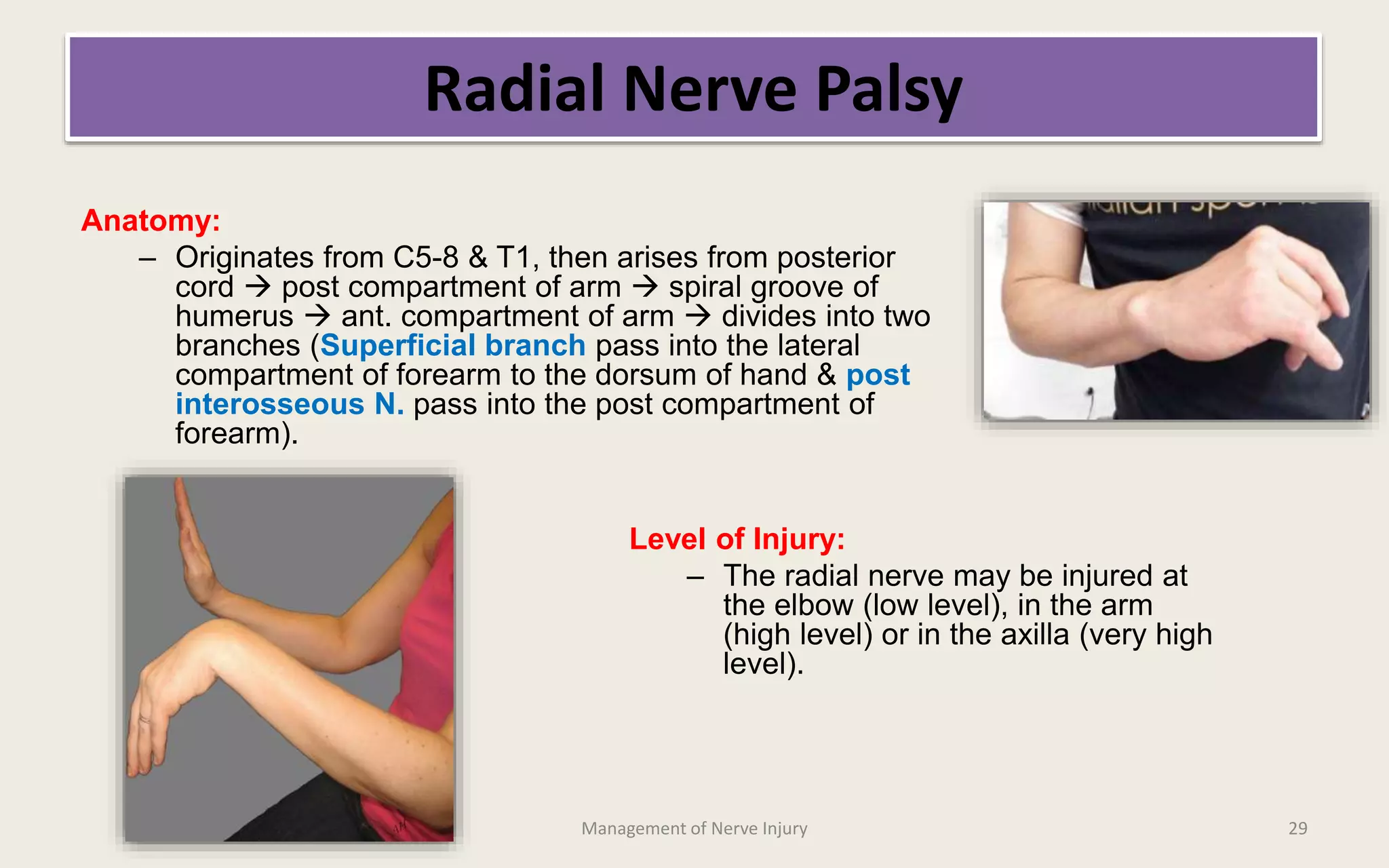 Management of Nerve Injury | PPTX