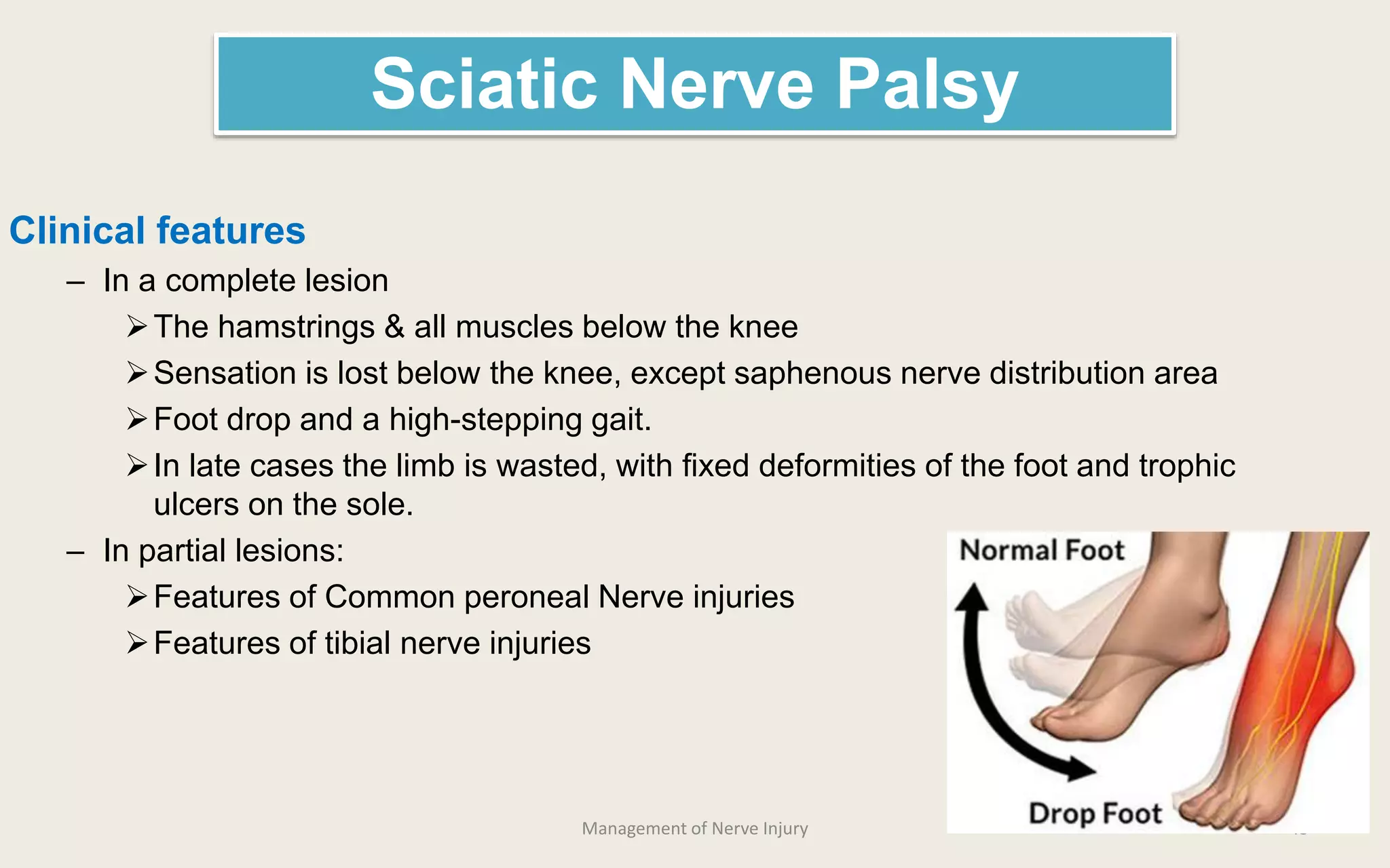 Management of Nerve Injury | PPTX