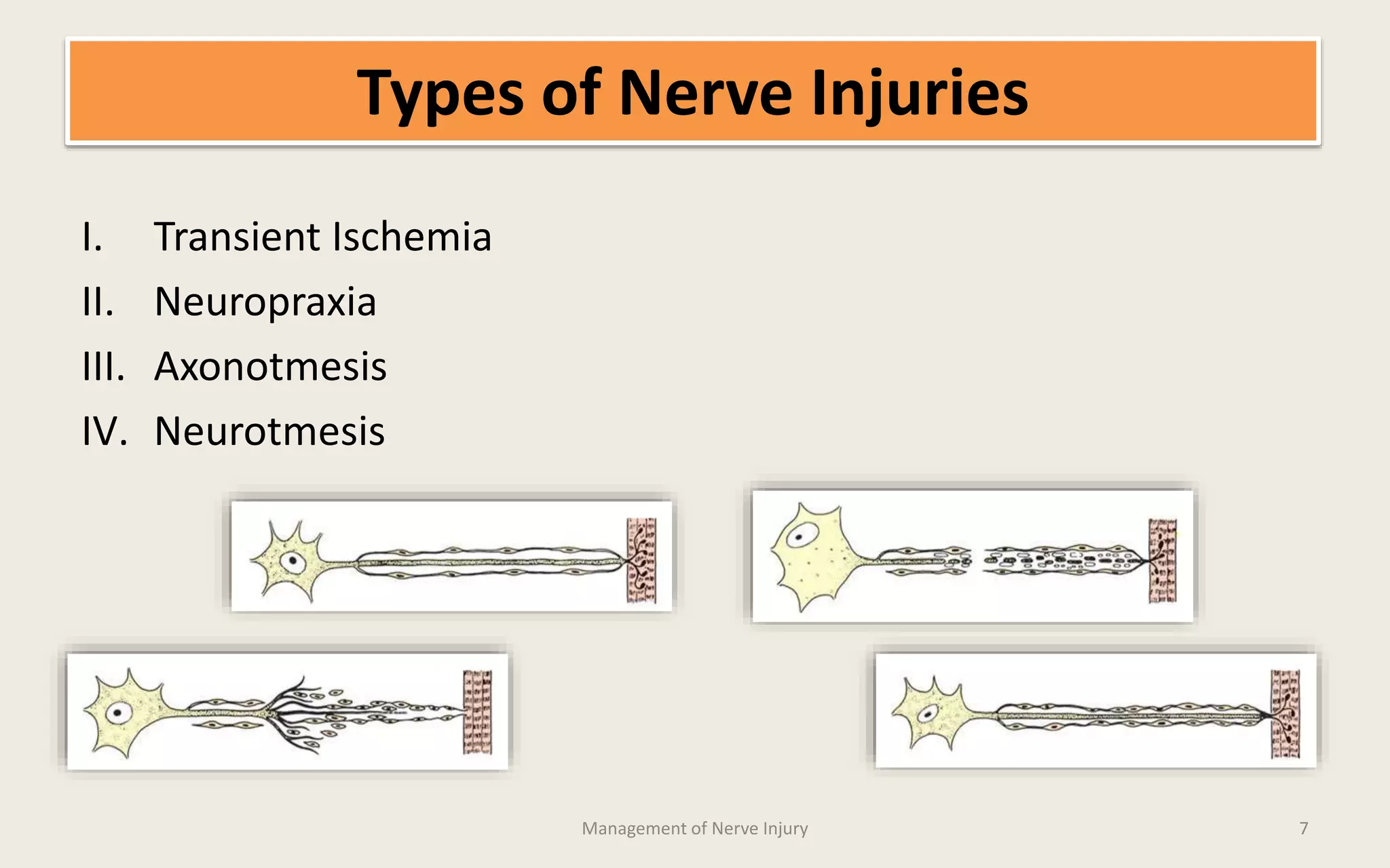 Management of Nerve Injury | PPTX