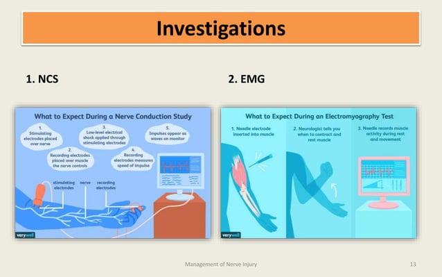 Management of Nerve Injury | PPTX