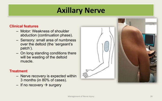 Management of Nerve Injury | PPTX