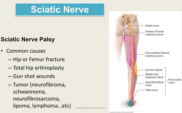 Management of Nerve Injury | PPTX
