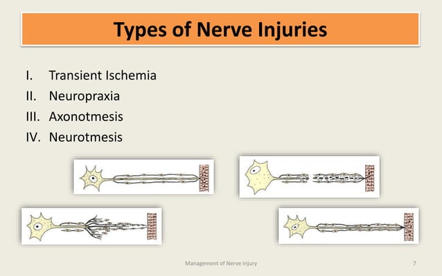 Management of Nerve Injury | PPTX