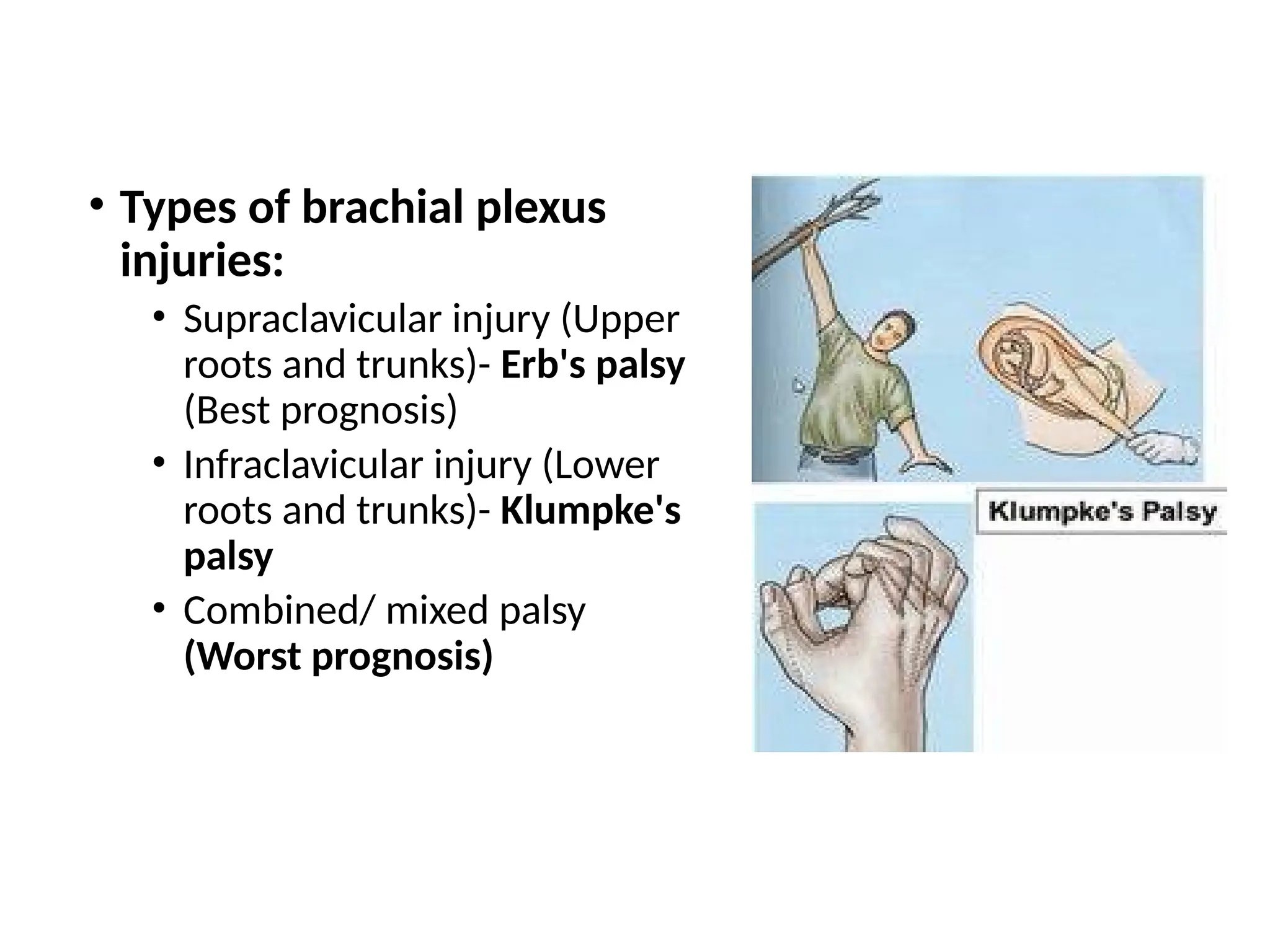 NERVE INJURY-WPS Office. Sciatic nerve and common Peroneal nerve | PPTX