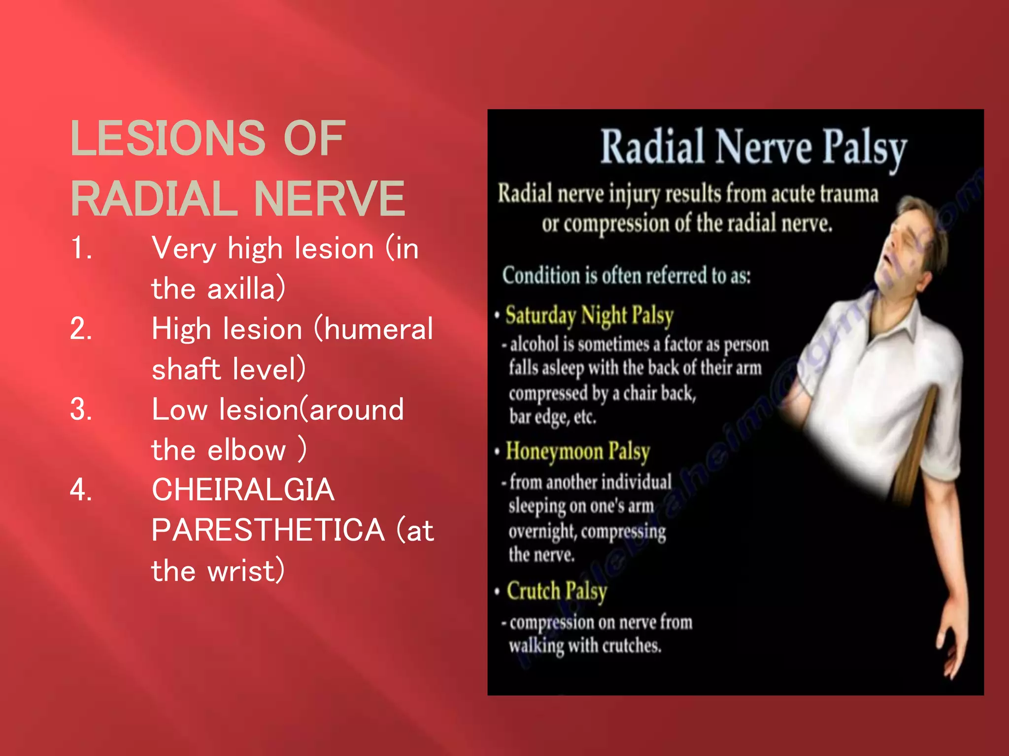 Nerve injury and its treatment | PPTX