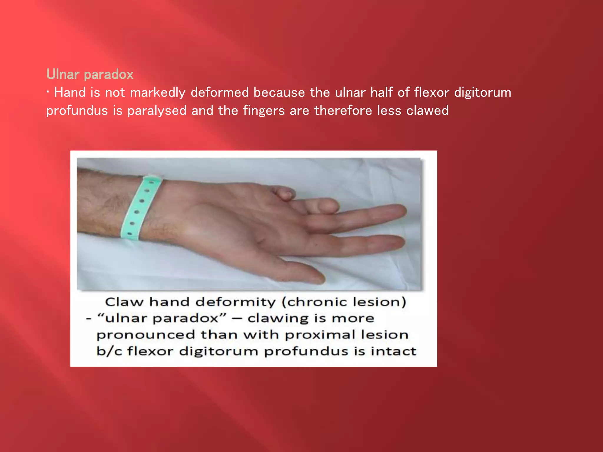 Nerve injury and its treatment | PPTX