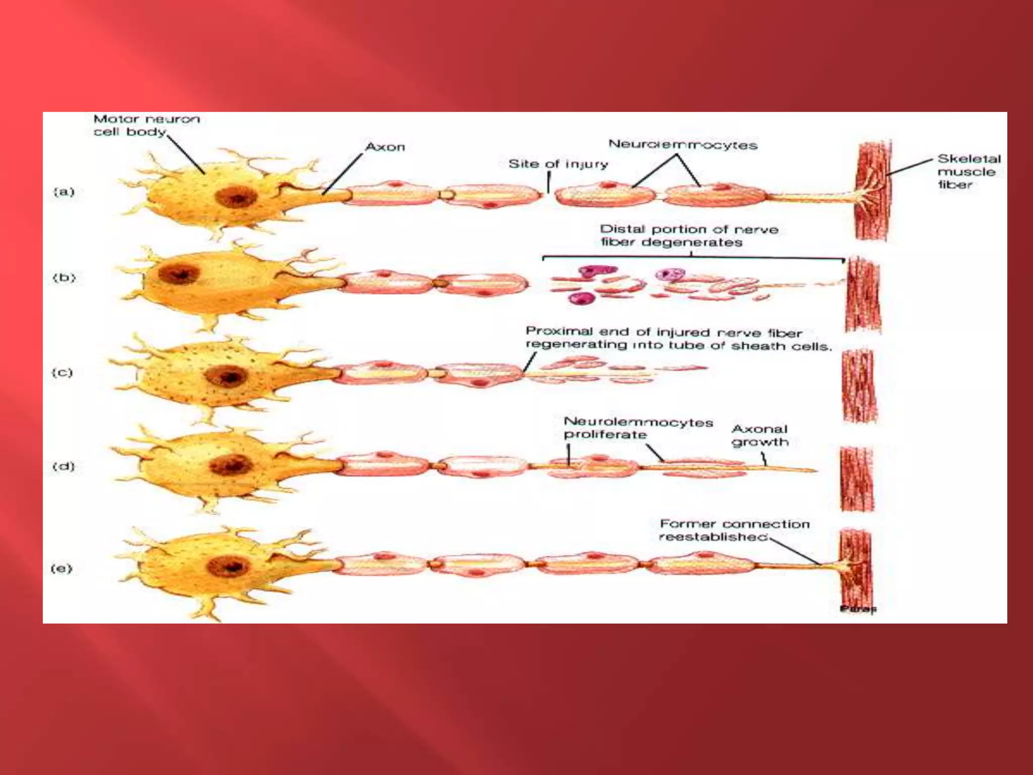 Nerve injury and its treatment | PPTX
