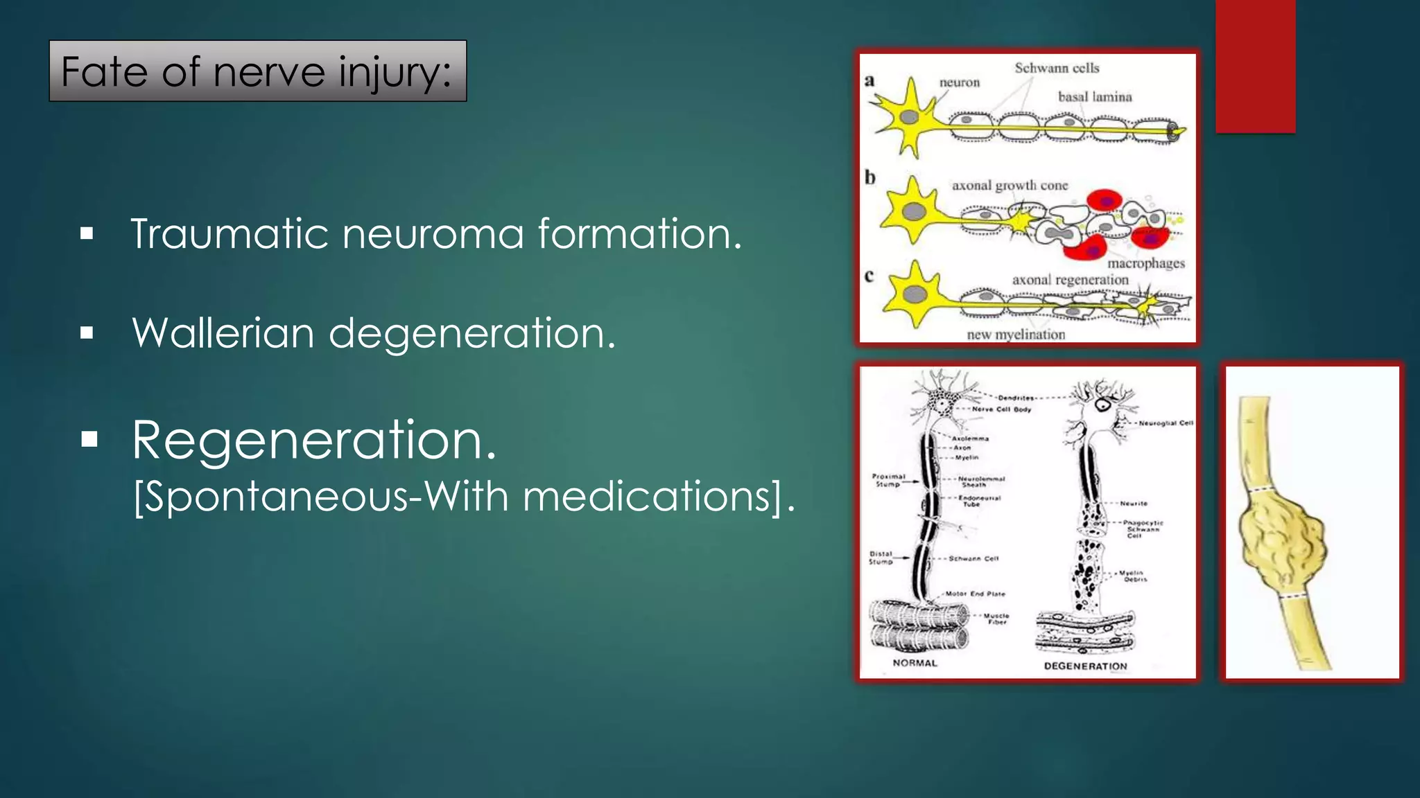 Nerve injury and repair | PPT