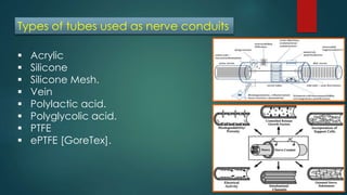 Nerve injury and repair | PPT