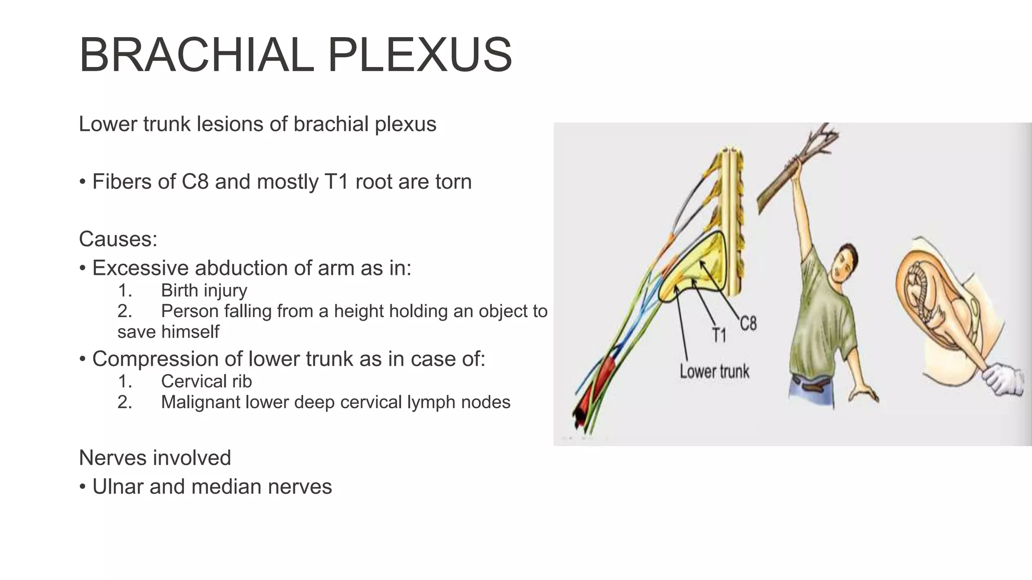 Nerve injury of upper limb | PPTX