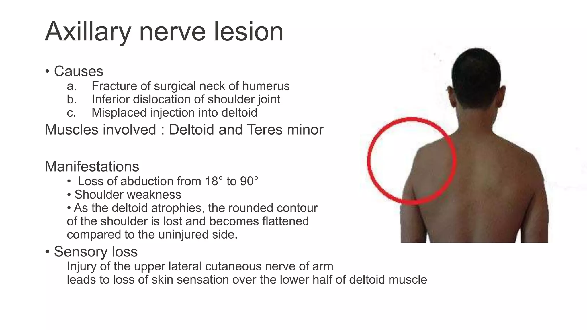 Nerve injury of upper limb | PPTX