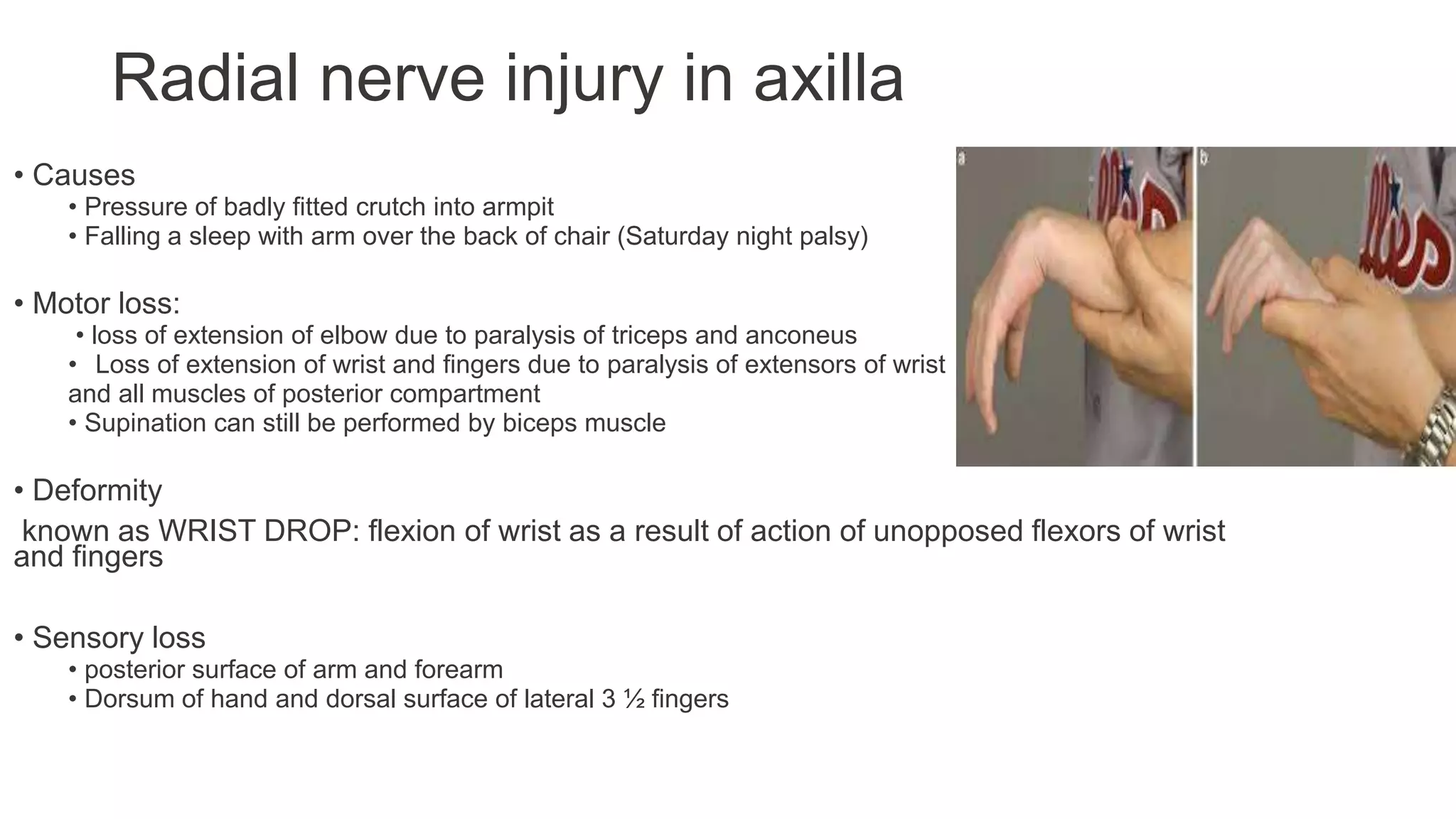 Nerve injury of upper limb | PPTX
