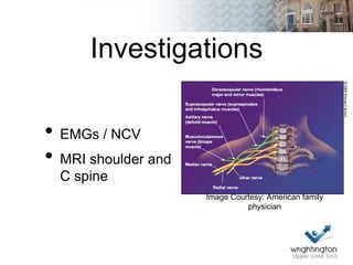 Nerve lesions around the shoulder | PPTX