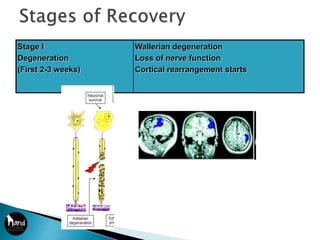 Nerve repair postop rehab | PPTX