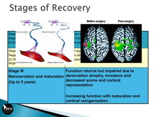 Nerve repair postop rehab | PPTX