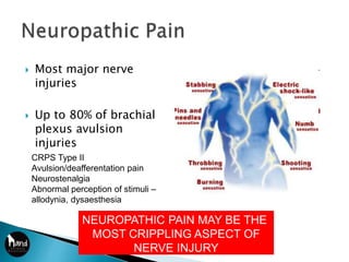 Nerve repair postop rehab | PPTX