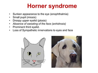 Nerves-Paralysis and Paresis.pptx