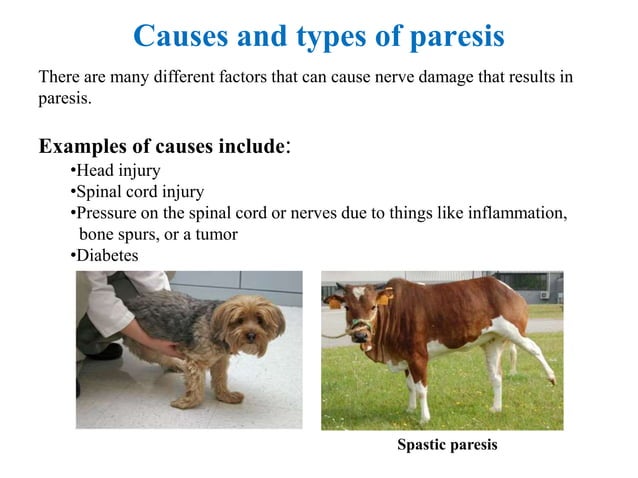 Nerves-Paralysis and Paresis.pptx | Brain and Nervous System Disorders ...