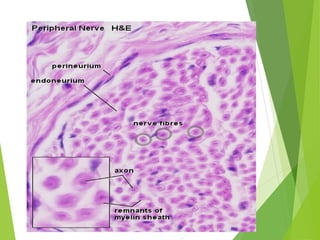 Peripheral Nerve Slide