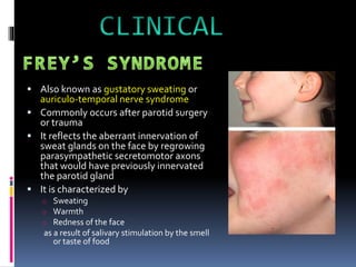 Nerves and vessels of parotid gland | PPTX