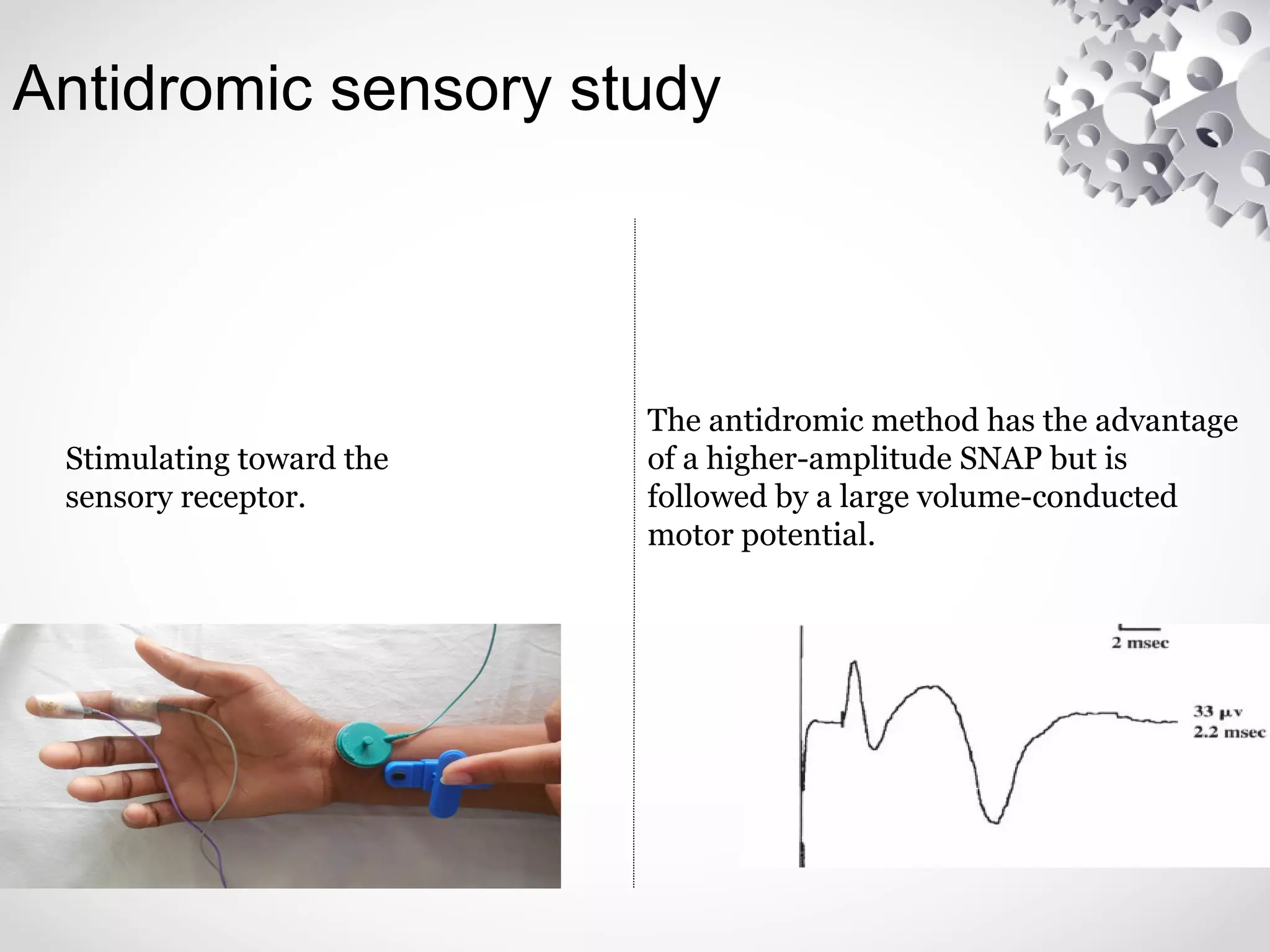 Nerves conduction study | PPT