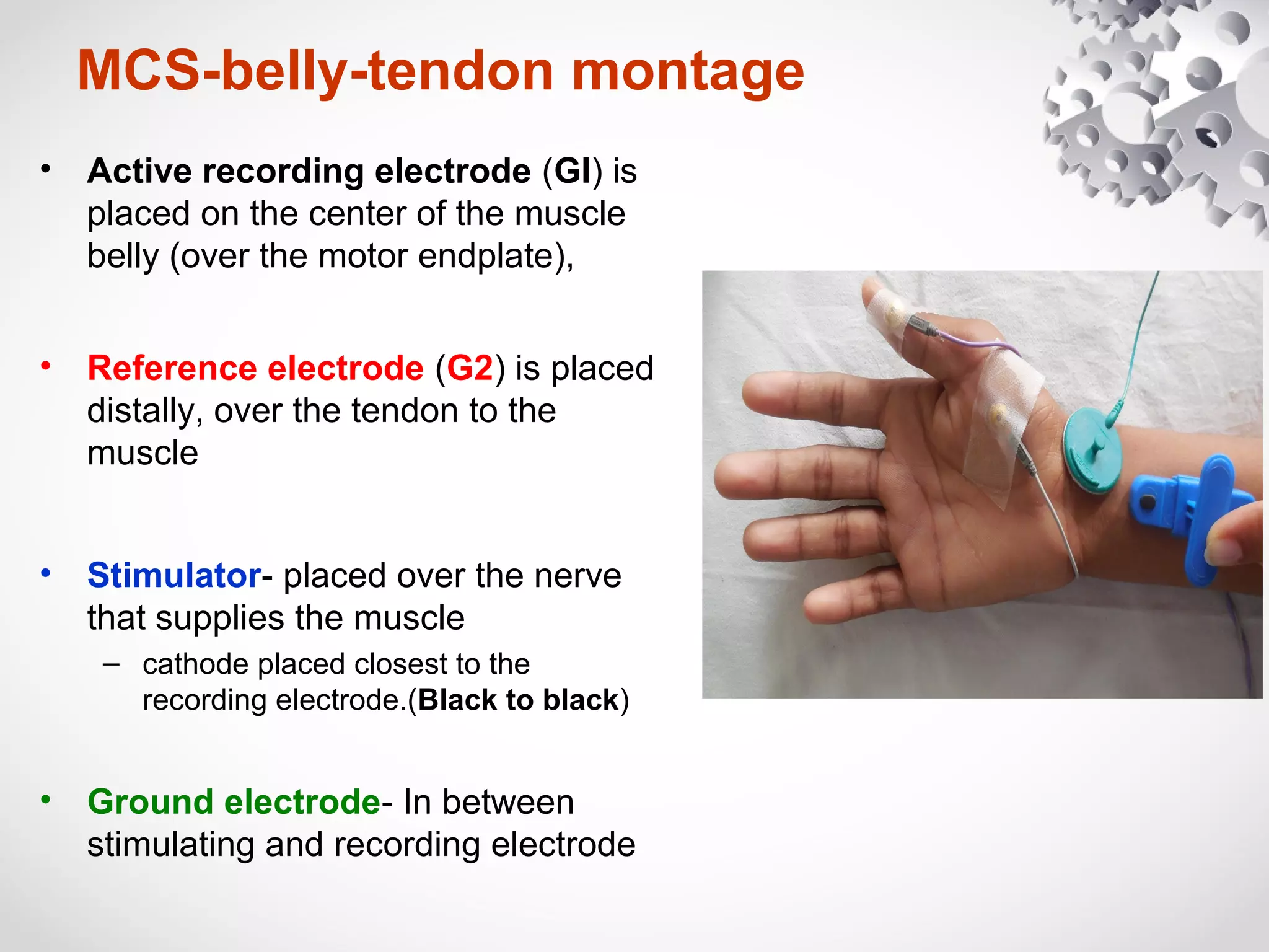 Nerves conduction study | PPT